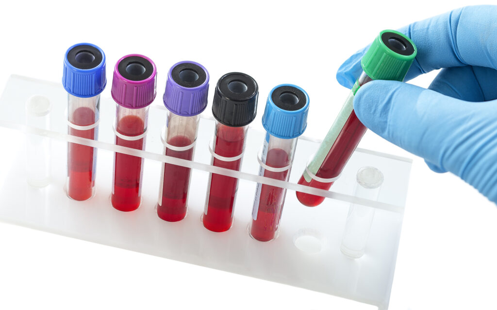 Blutabnahme - Dr. Michael Kastler